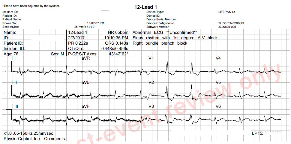 Artifact | ECG Guru - Instructor Resources
